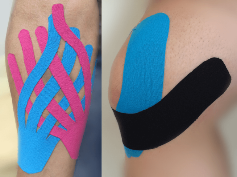 ¿Para qué se utiliza el vendaje neuromuscular? | CEM Canarias